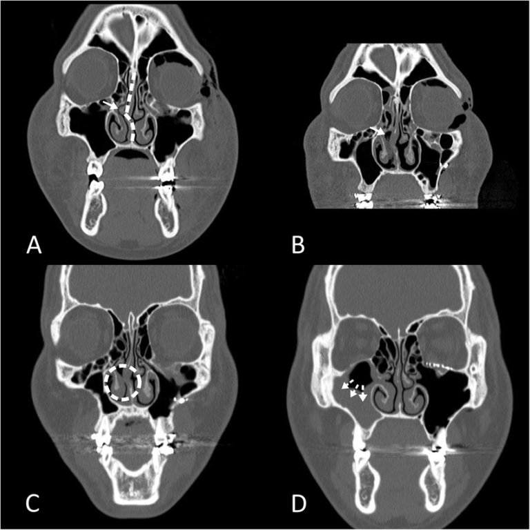 CT Scan Face - Godawari CT Scan