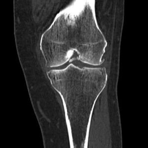 CT Scan Joints - Godawari CT Scan